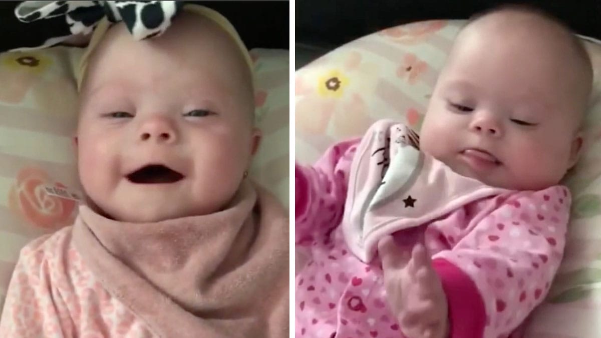 Mamma kritiseras när hon behåller tvillingar med Downs syndrom – hennes ...