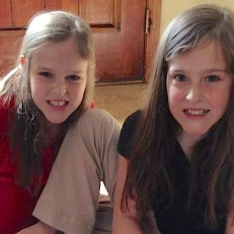 Cojoined twin sisters who were famously ‘cut In half’ in 2006 are now ...