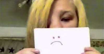 Sarah Atwell: The girl with half a face